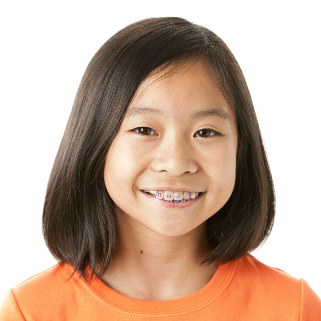 How Much Do Braces Cost for Kids? Average Price in 2025 ...